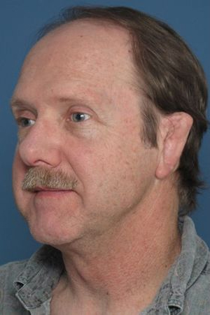 Beverly Hills Plastic Surgeon Office - Reinisch Plastic Surgery