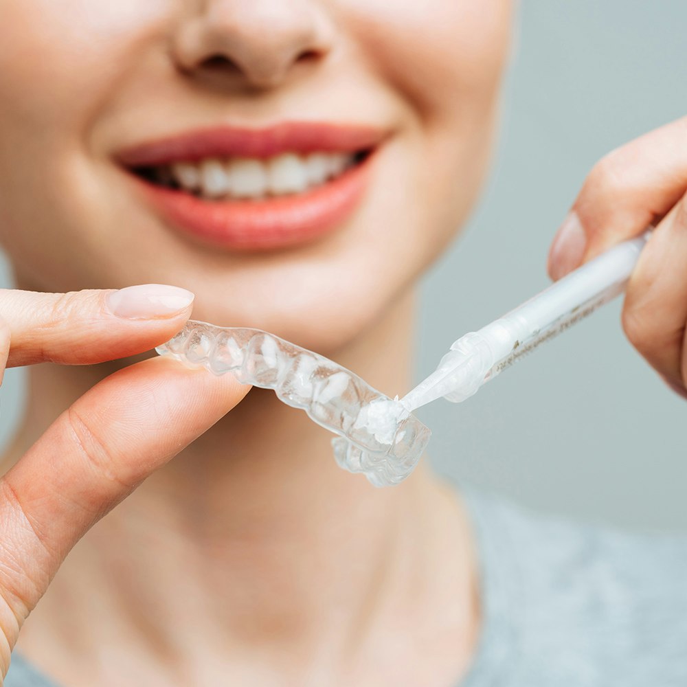 Teeth Whitening New Jersey - NÜVA Smile