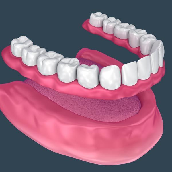 Dentures Orland Park, IL - Premier Dental & Implant Center