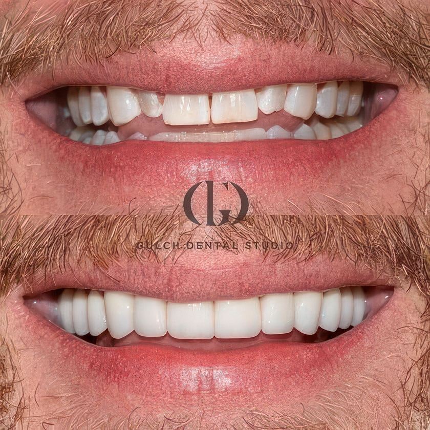 Cosmetic Dentistry Nashville, TN - Cosmetic Dentist - Gulch Dental Studio