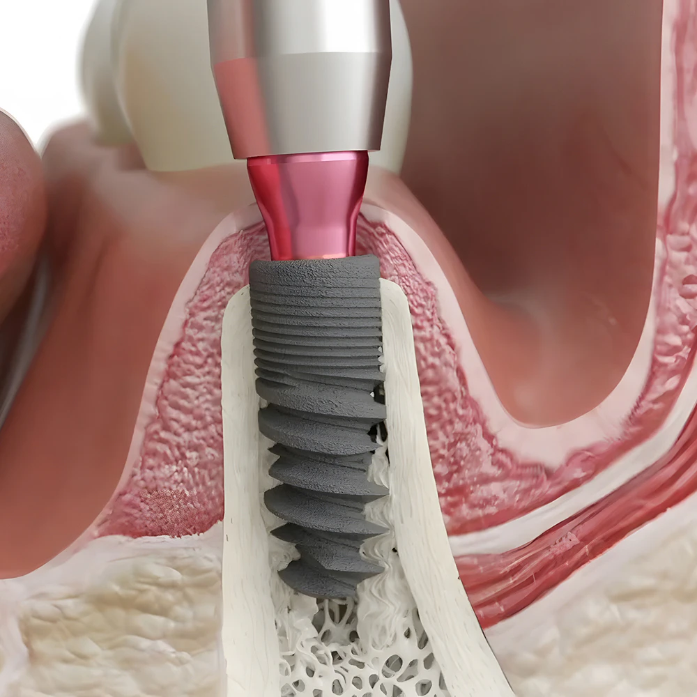 Advanced Oral Surgery of Tampa: Oral Surgeon Tampa, FL - Valrico, FL ...