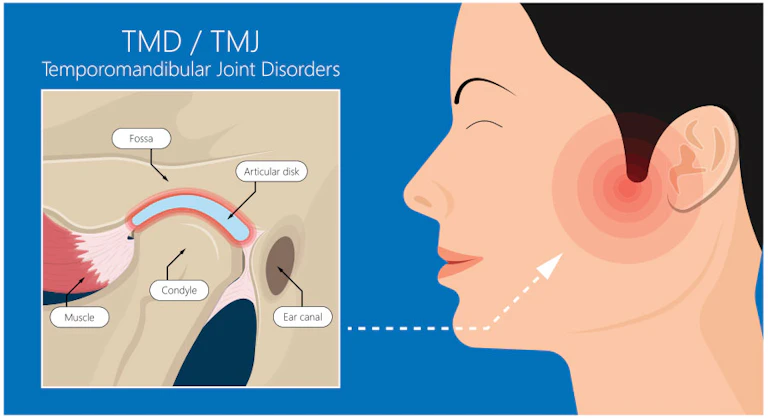 TMJ Albuquerque, NM - TMJ Treatment - Peak Family Dentistry