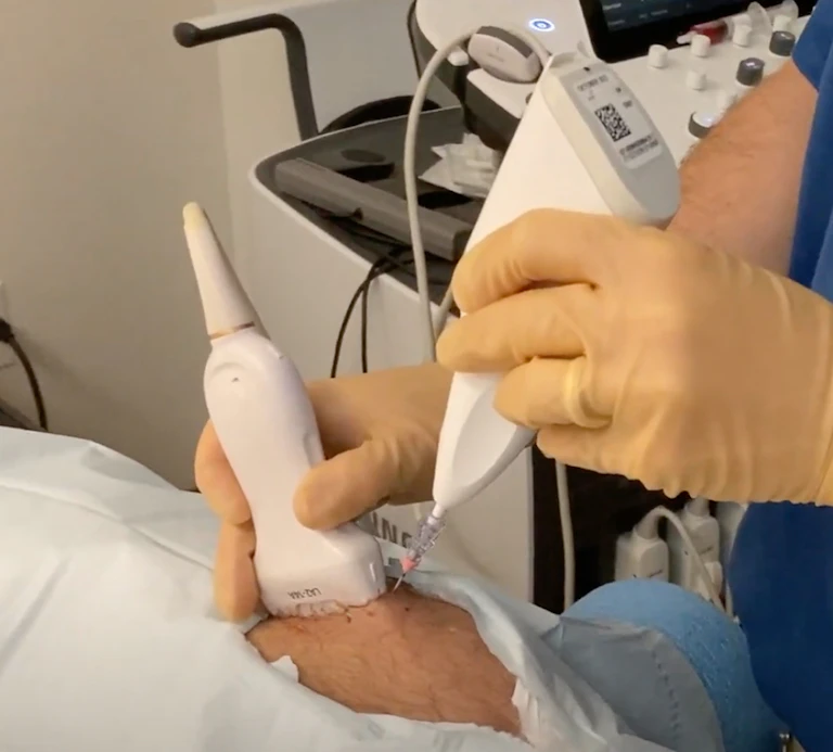 Plantar Fasciitis Hartford County, CT - Advanced Foot & Ankle Specialists