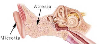 Ear Anatomy Explained – Microtia & Atresia Differences | Dr. Bonilla