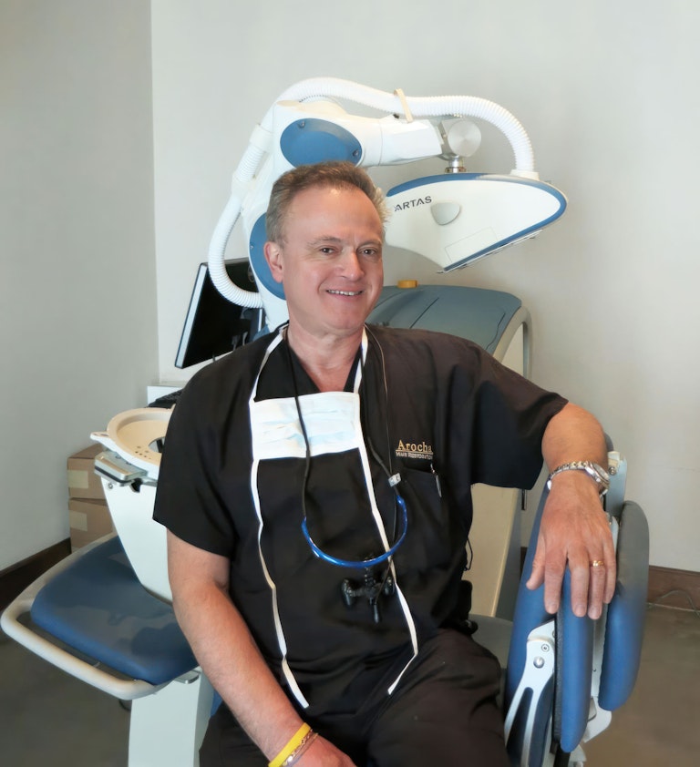 FUE Hair Transplant Houston, TX - Arocha Hair Restoration