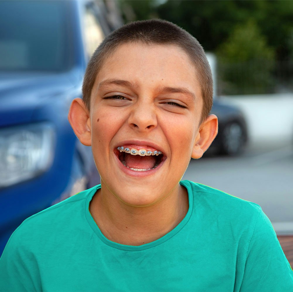 Braces Round Rock, TX - Metal Braces - Jovan Orthodontics