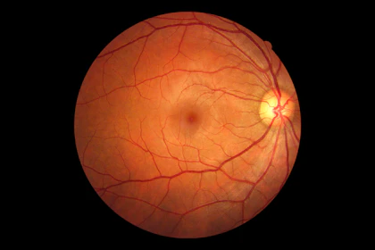 Maynor & Mitchell Eye Center: Optometrist Huntsville AL