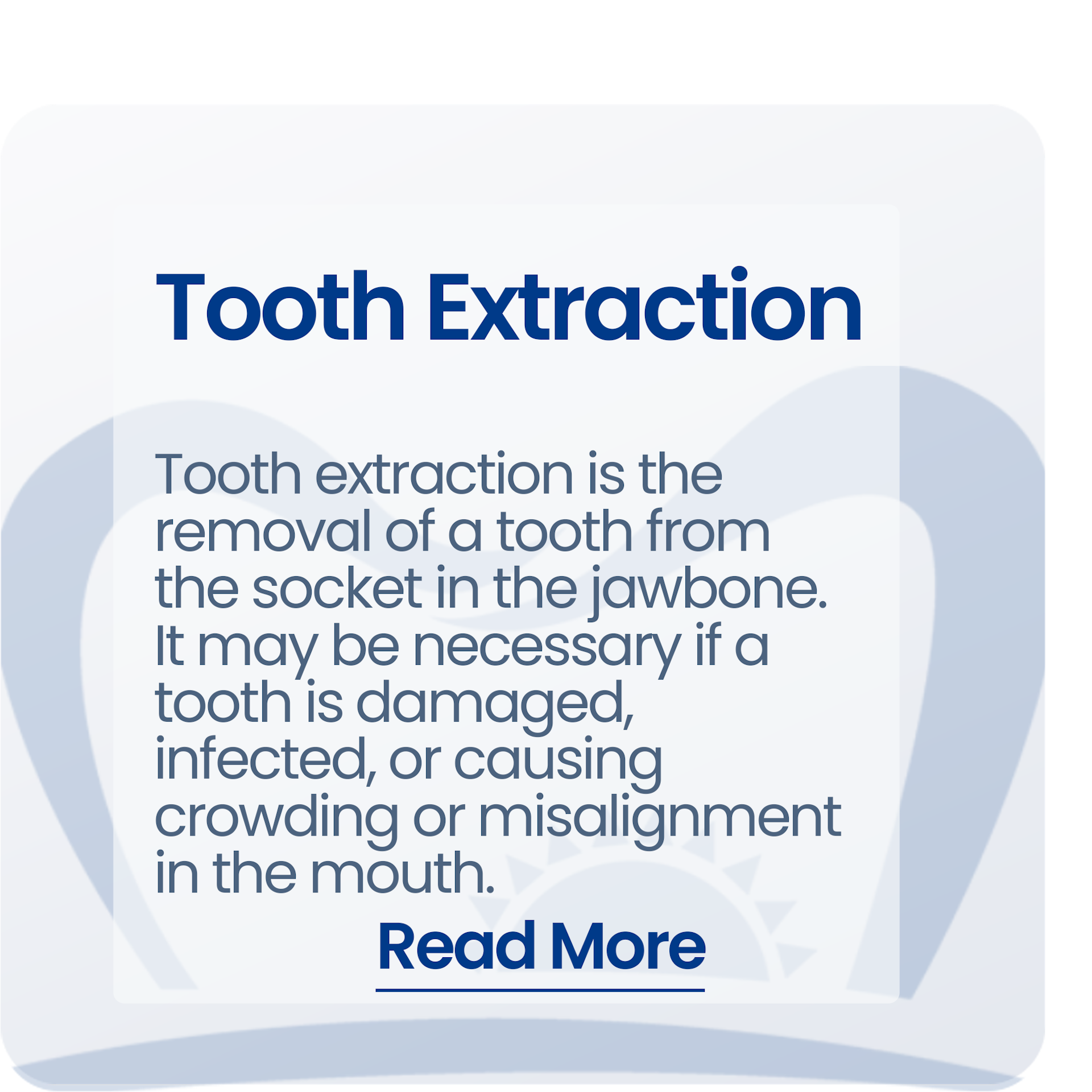 Tooth Extraction Los Algodones, MX - Oasis Dental Group